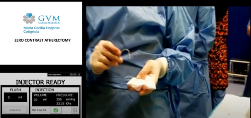 Automated CO2 Angiography and EVAR