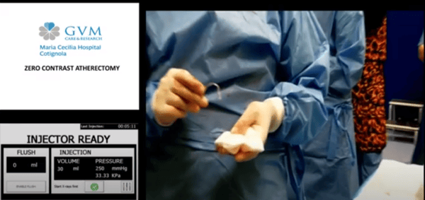 CO2 automatic angiography – Standard Technique