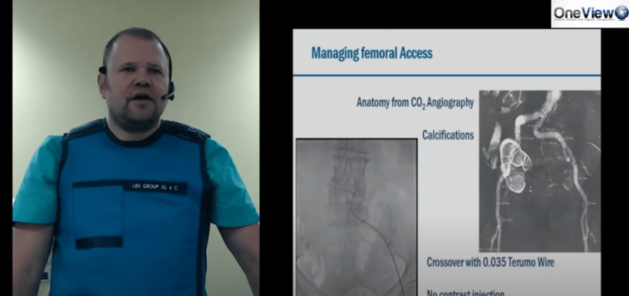 CO2 automatic angiography – Standard Technique
